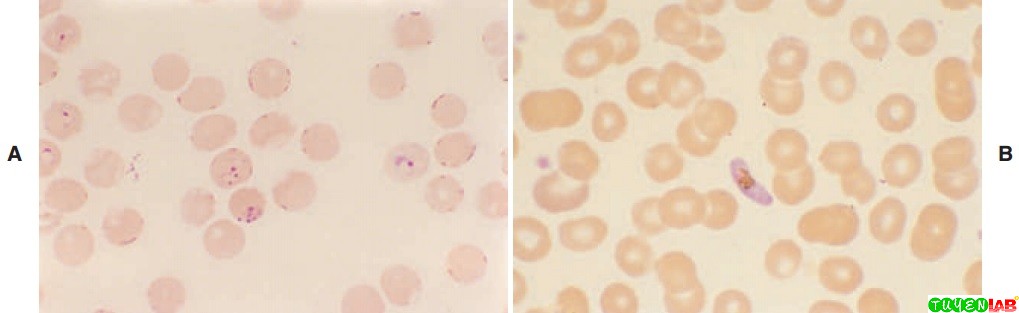 [Parasitology] Atlas of Diagnostic Parasitology | Free Medical Atlas