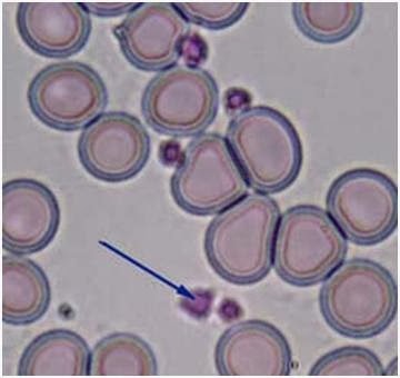 Groupe 35 - Année 2013-2014: Pourquoi le sang est-il rouge