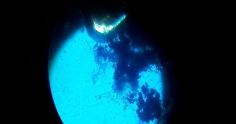 Fumagina no limão (Capnodium citri) - Herbário Virtual de Fitopatologia ...