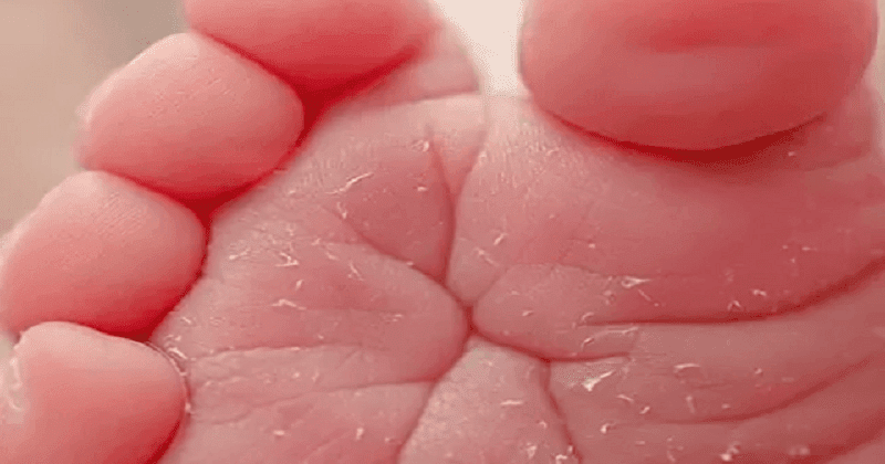 Cara Mengobati 3 Jenis Kelainan Pada Kaki Bayi - Klinikabar