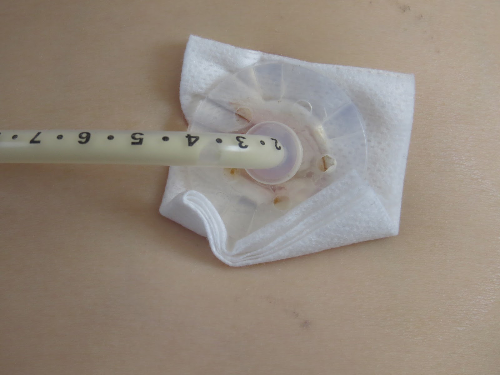 4 lizards and a ladybug: peg tube