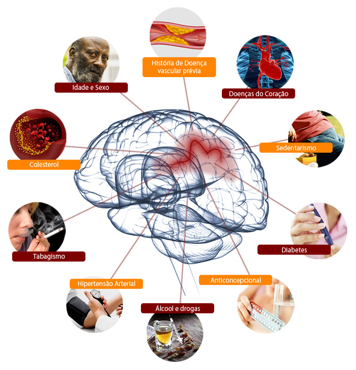 VOCÊ E O AVC: CONHECER PARA PREVENIR: FATORES DE RISCO PARA O AVC VOCÊ E O AVC: CONHECER PARA PREVENIR: FATORES DE RISCO PARA O AVC