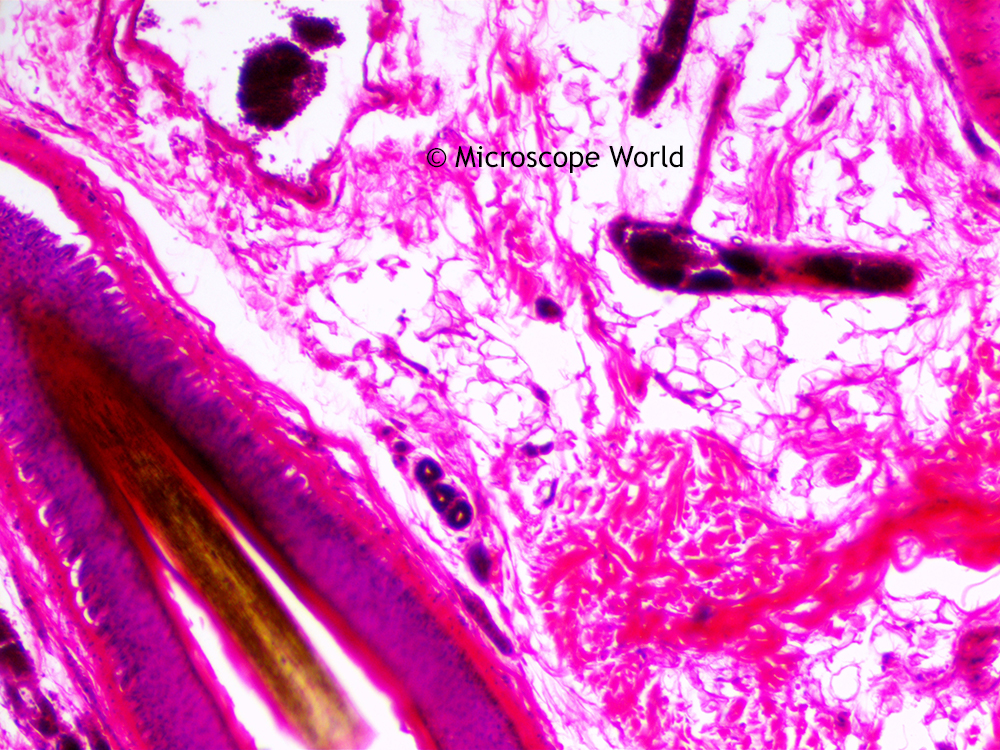 Hair Under Microscope Labeled