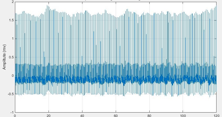 Biomedical Signal and Image Processing projects using Matlab and ...