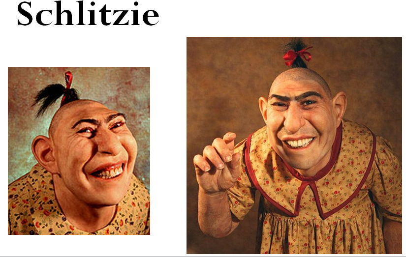 Neuropsicopedagogia na sala de aula: Macrocefalia e Microcefalia