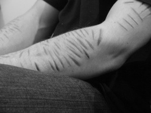 Self Injury and the Body: Levels of Self Injury Through Photos