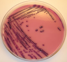 The Kuhol and the E. coli