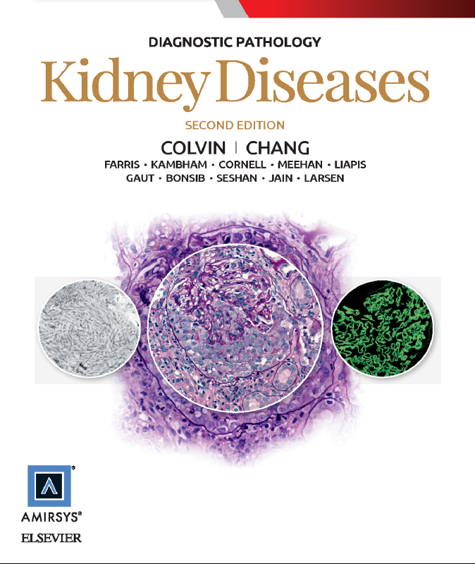 Diagnostic Pathology: Kidney Diseases 2nd Edition - Medical Book For ...