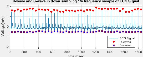 Biomedical Signal and Image Processing projects using Matlab and ...