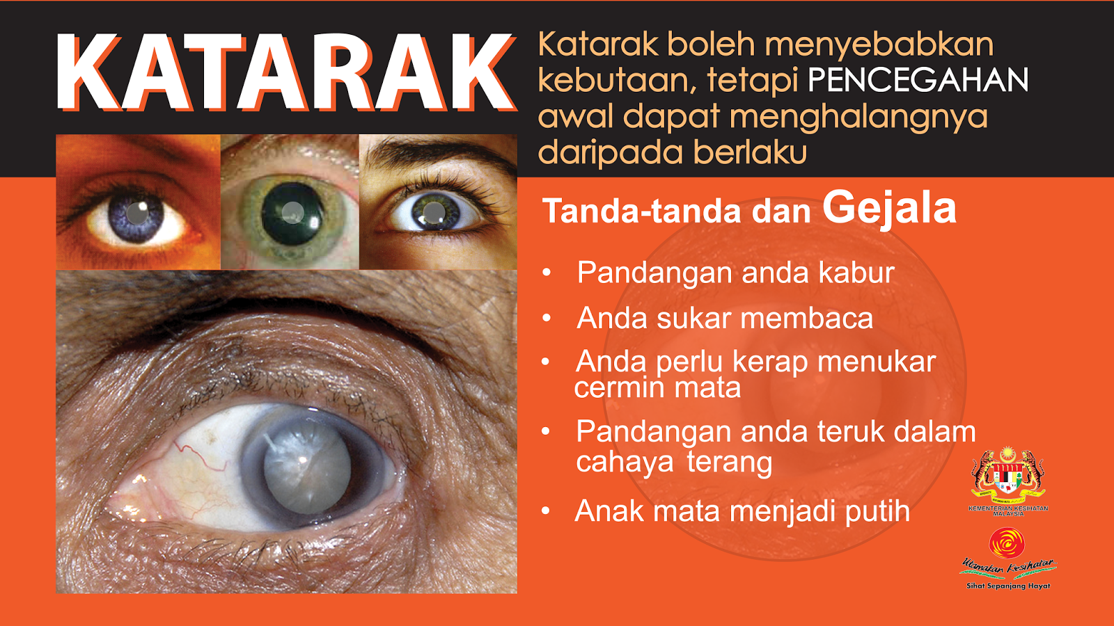Healthy Lifestyle Secrets: KATARAK - PENYAKIT SELAPUT MATA YANG TIDAK ...