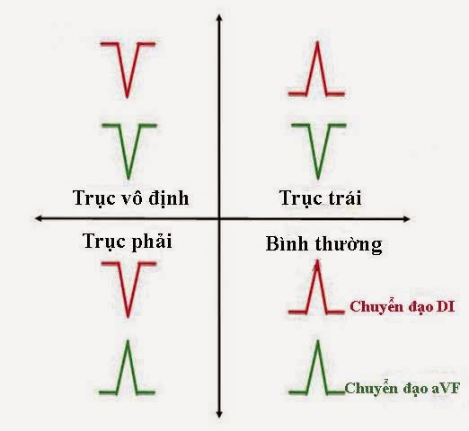 Góc nhỏ xíu xiu của CC: [THDDT] CHƯƠNG 6: CÁCH XÁC ĐỊNH TRỤC ĐIỆN TIM ...