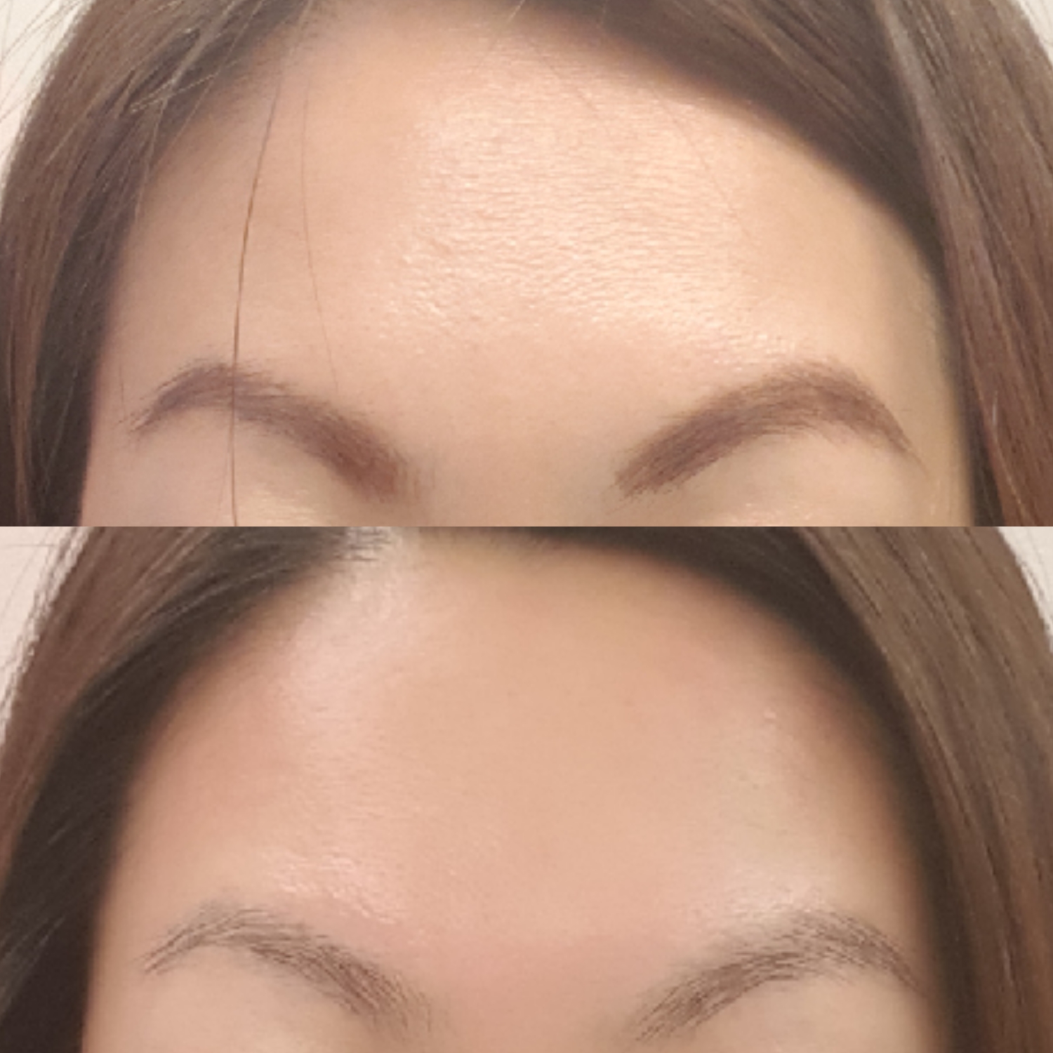 I Tried a Facial That Reversed My DNA - The Skin Radar