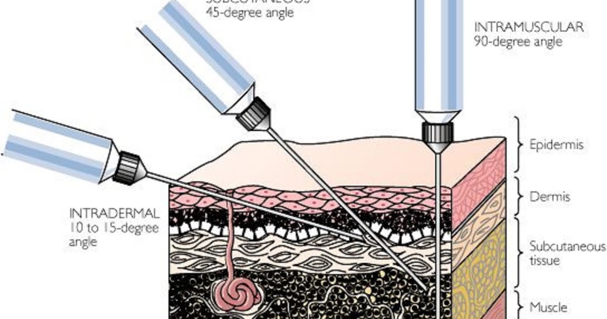 Medical and Health Science: Injection angles for pharmacology!!!
