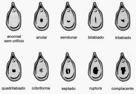 Comprovação de virgindade em concurso: absurdo ou exigência ...