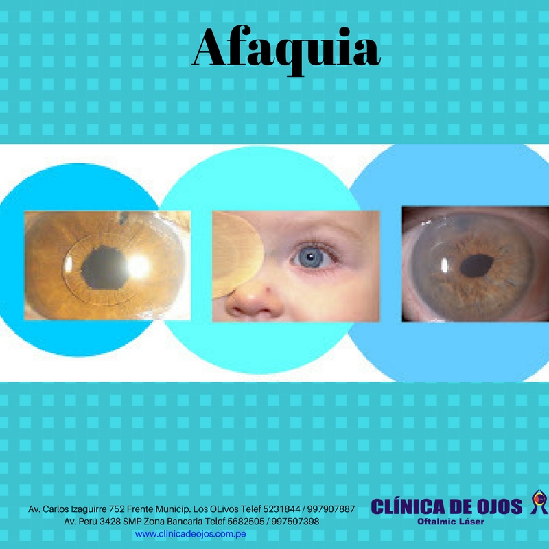 Clínica de Ojos Oftalmic Láser: Afaquia