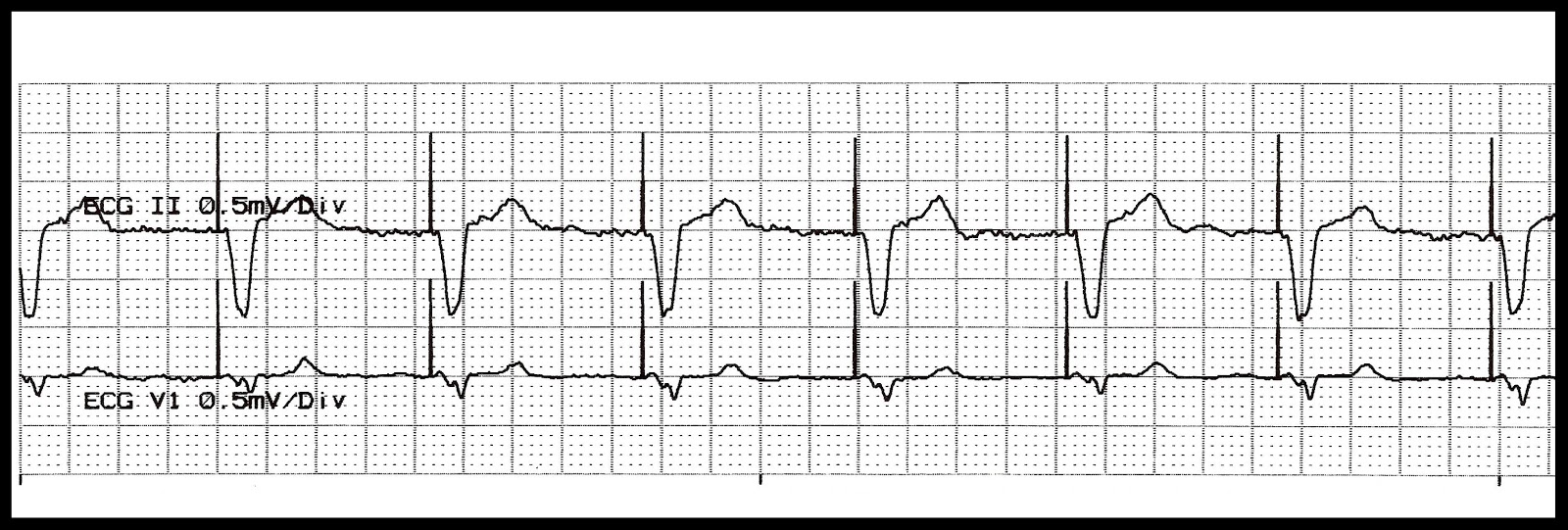 Basic EKG Rhythm Test 34