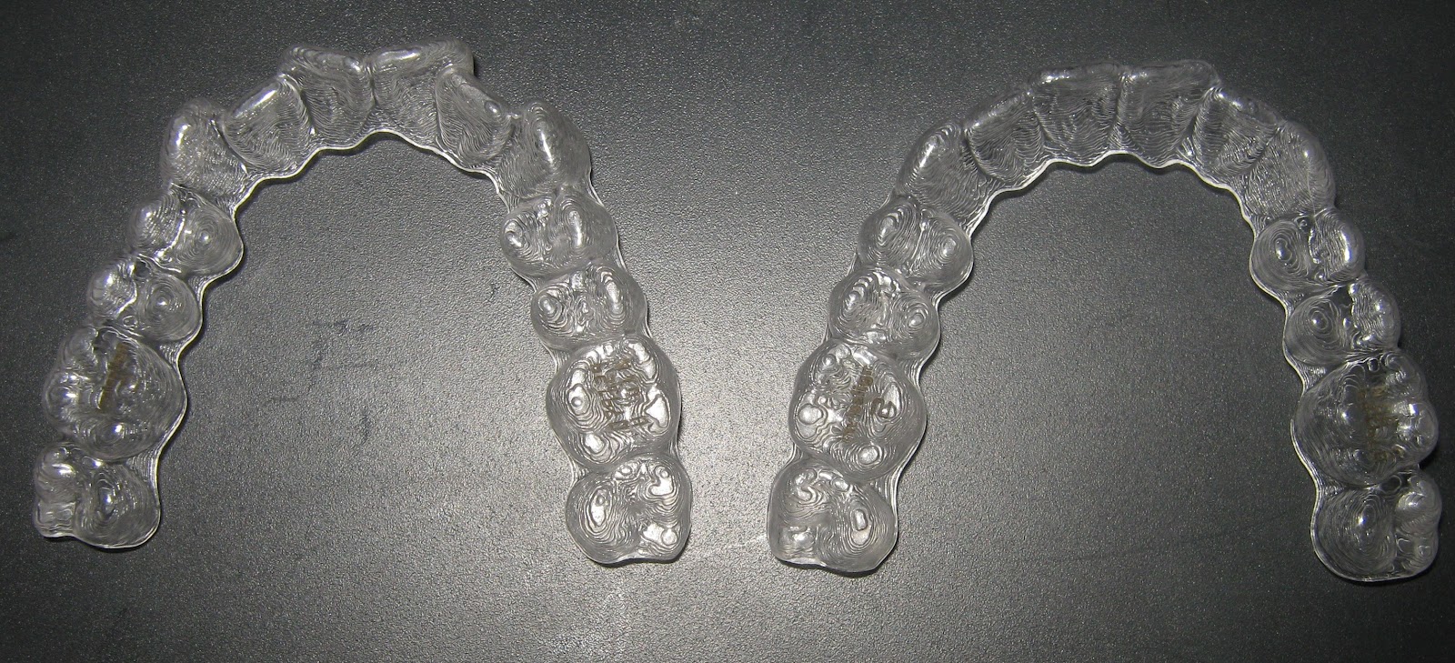 Br@ndy's Invisalign Journey: Tray 20!