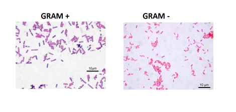 Bakteri Gram Positif dan Bakteri Gram Negatif, Ternyata Ini ...
