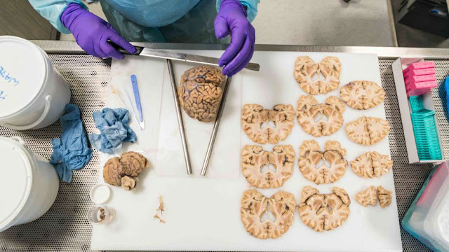 Our Parkinson's Place: This Is What Happens To Your Brain When You ...