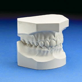 Omni Dental Group: Study Models and Wax Ups
