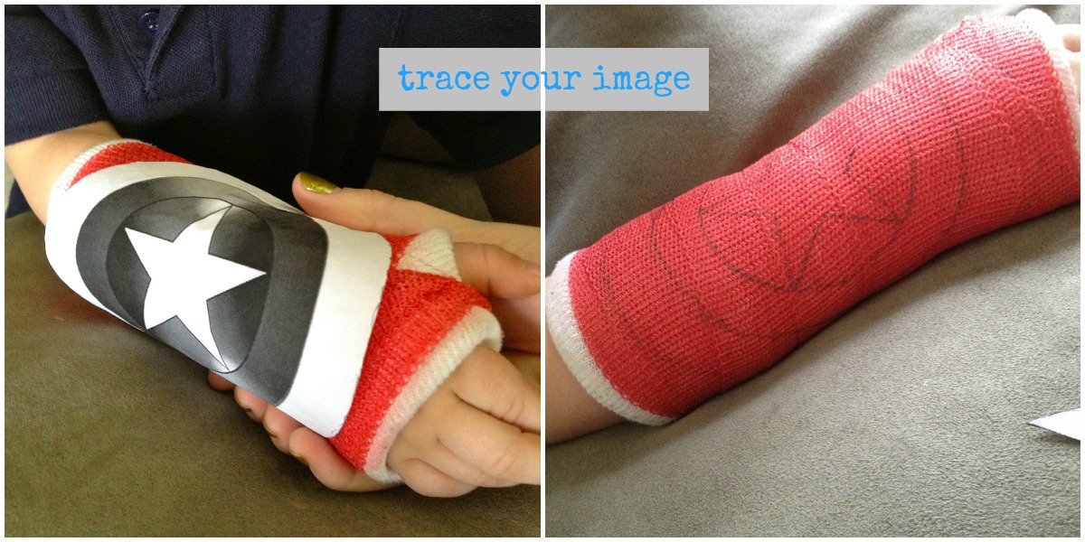 Painted Cast Art - Brittany Estes