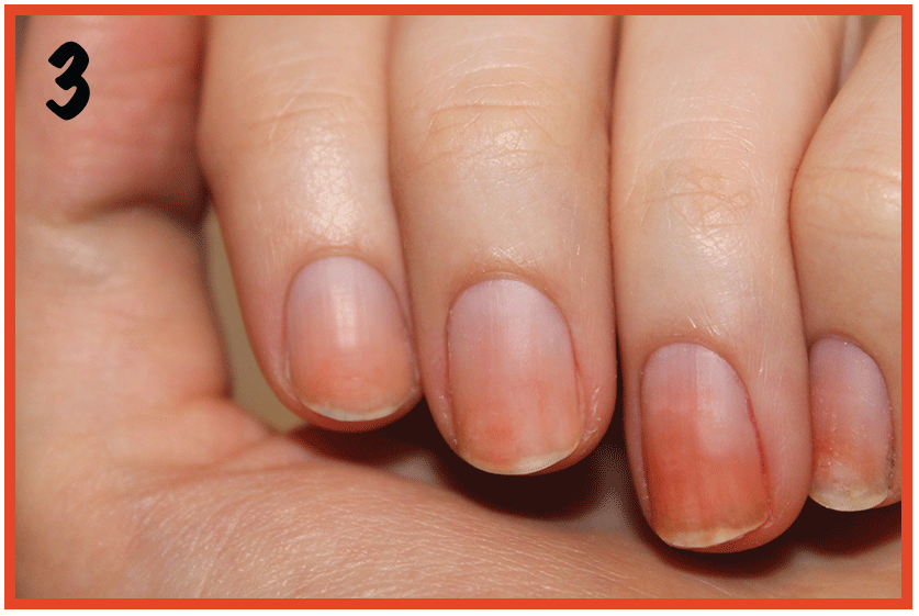 eBeautyandCare: A bas cuticules et peaux mortes!