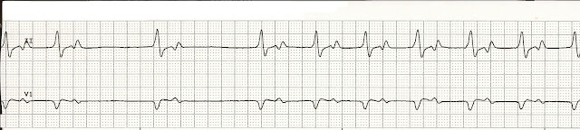 For in that sleep of death what dreams may come...