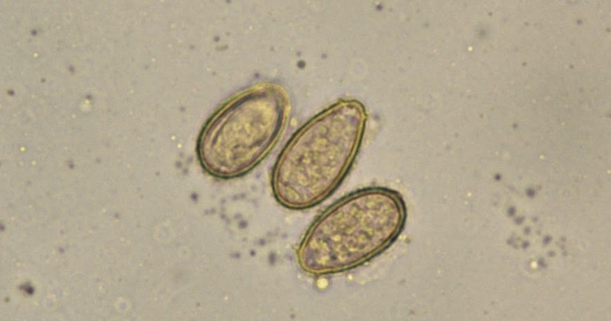 Clonorchis Sinensis Ova