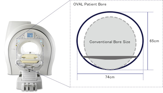 Radioblog Rx: Hitachi RM Echelon Oval 1.5T Ultra-Wide