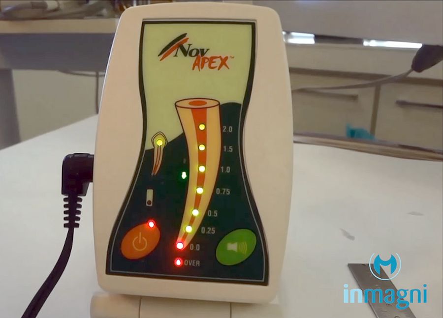 ENDODONTIA: Tratamento de canal importância da odontometria eletrônica ...