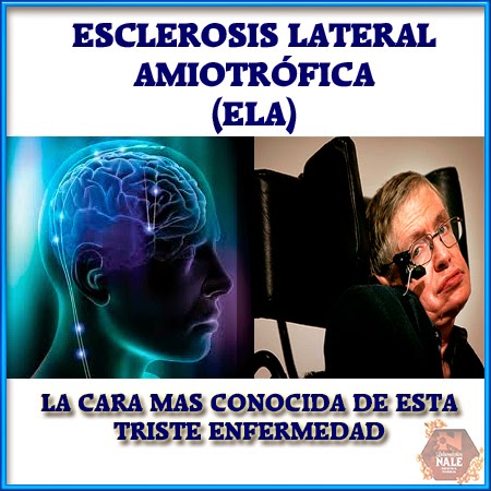 Grupo Lab. Nale: Esclerosis Lateral Amiotrófica (ELA ó ALS)