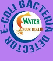 AUTOMATED E-COLI BACTERIA DETECTOR SYSTEM: About the Project