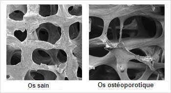 Comment agit l'impesanteur sur la circulation sanguine et la structure ...