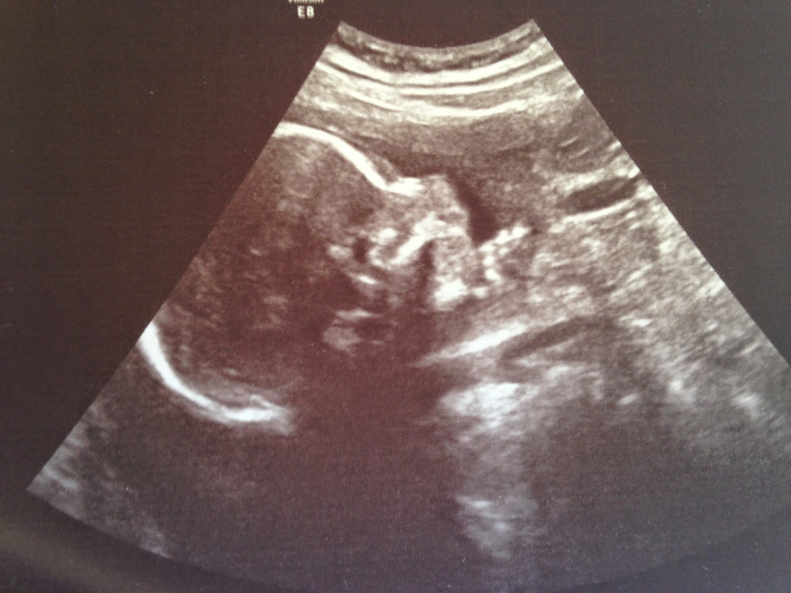 22 Week Pregnancy Update | Baby #2 | Emily and Indiana