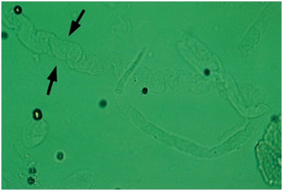 Pemeriksaan Mikroskopik Sedimen Urin | Update ATLM