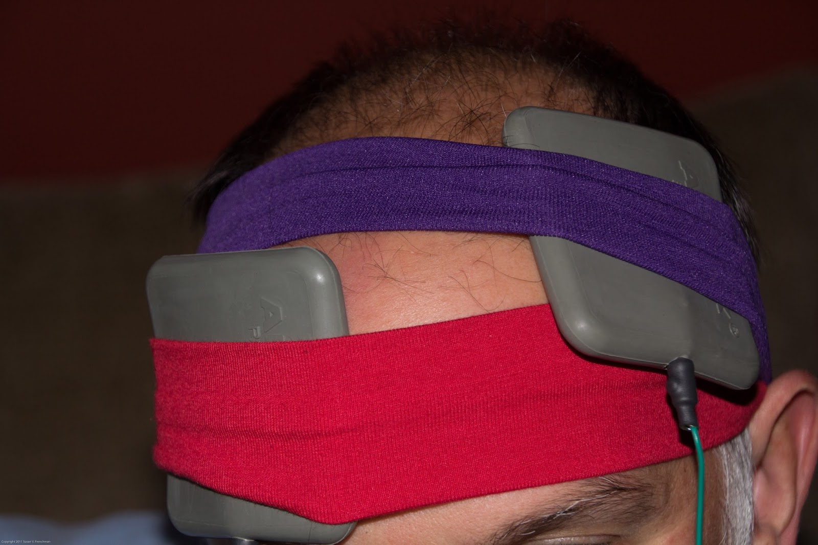 Insight, a growth project driven by tDCS: The Clinical Uses of tDCS ...