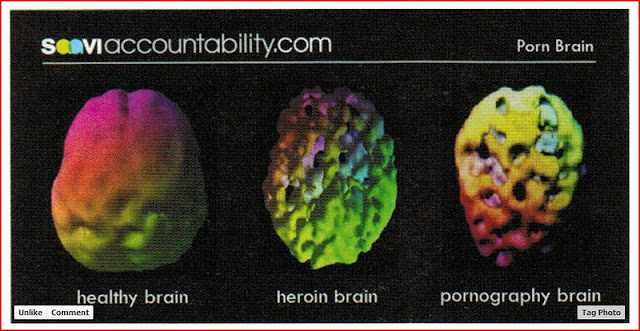 RRE Tribe & You: Do You Have a Healthy Brain?