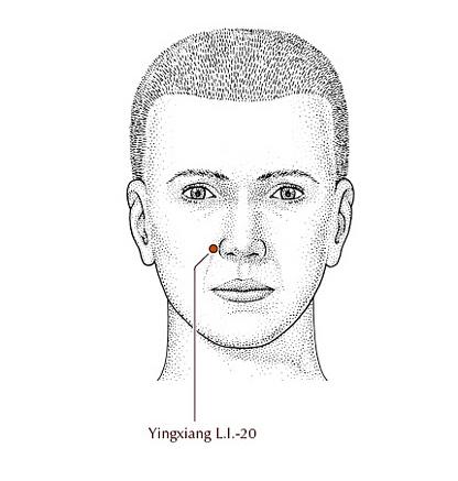 Acupuncture: LI - 20 (Large Intestine-20)