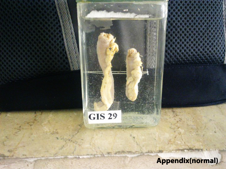 Medical Education for Students: Gross Specimens General Pathology (50 ...