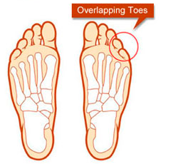 Abundance Of My Heart: November 2011