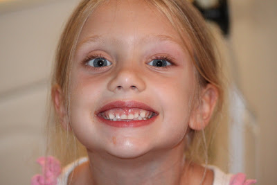 Mommy's Little Peanuts: ouch!