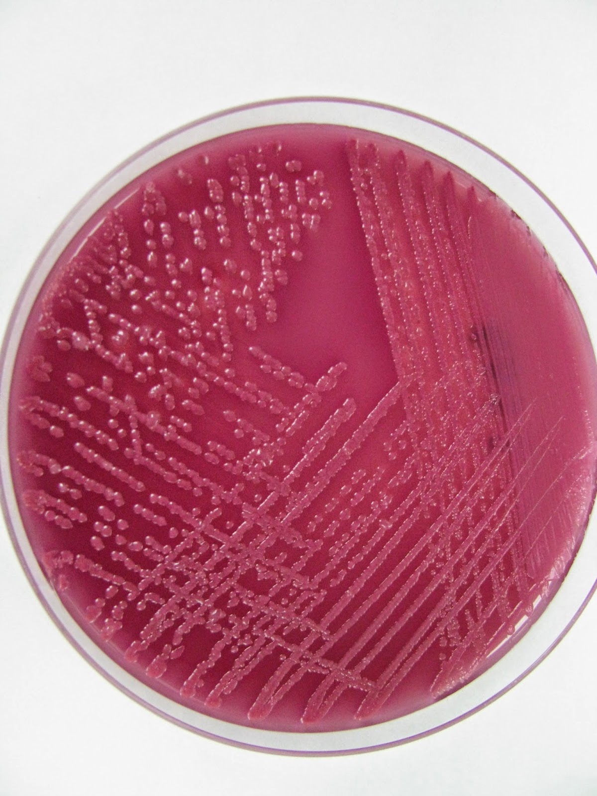 Xét nghiệm Y học: Nuôi cấy, phân lập, định danh Enterobacteriaceae