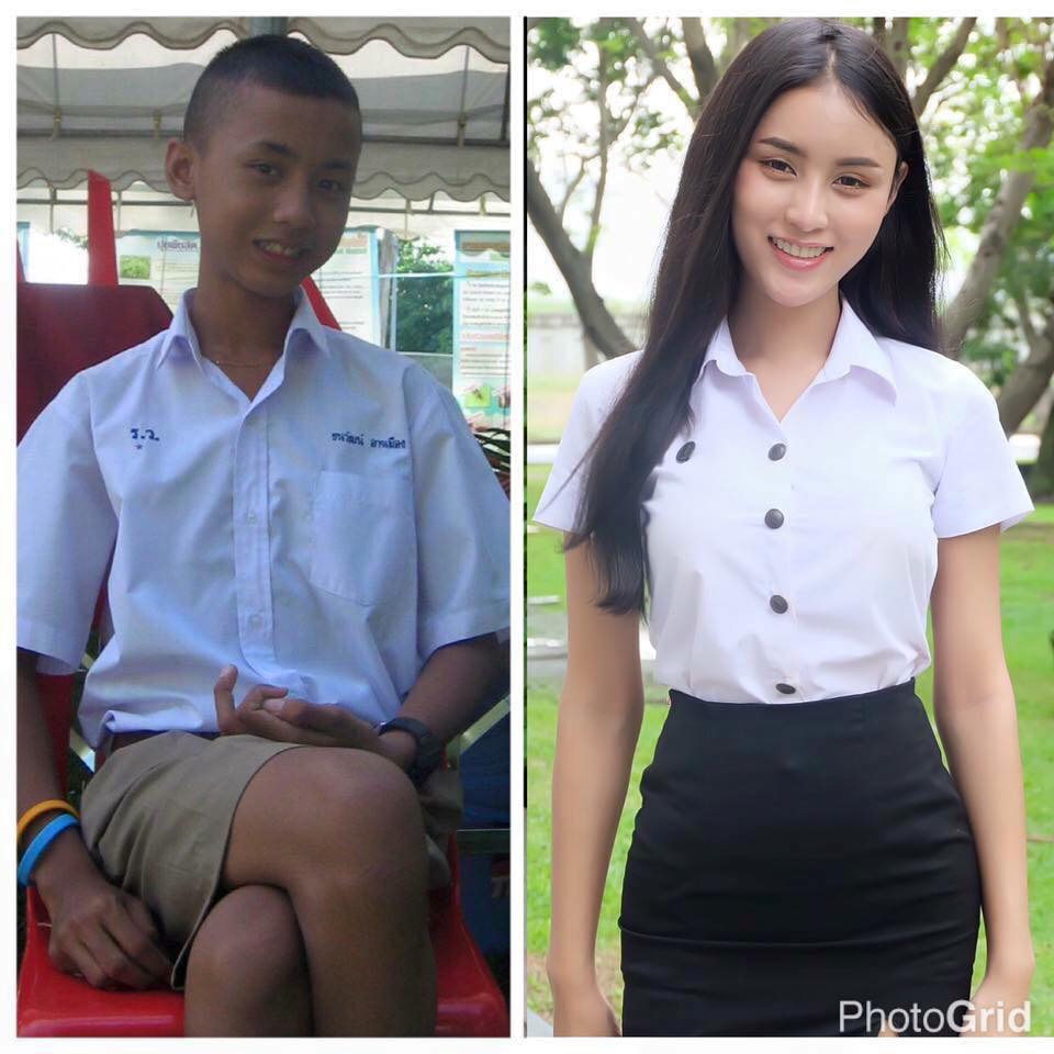 40 Foto Banci Thailand Sebelum Dan Sesudah Operasi | unik lucu keren ...