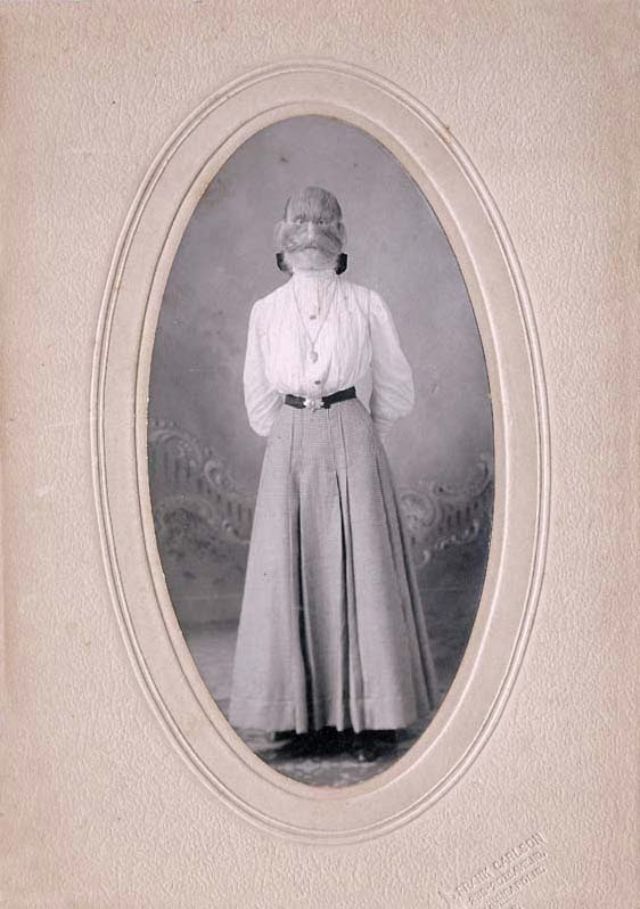 Amazing Vintage Photographs of the 'Minnesota Woolly Girl' Alice ...