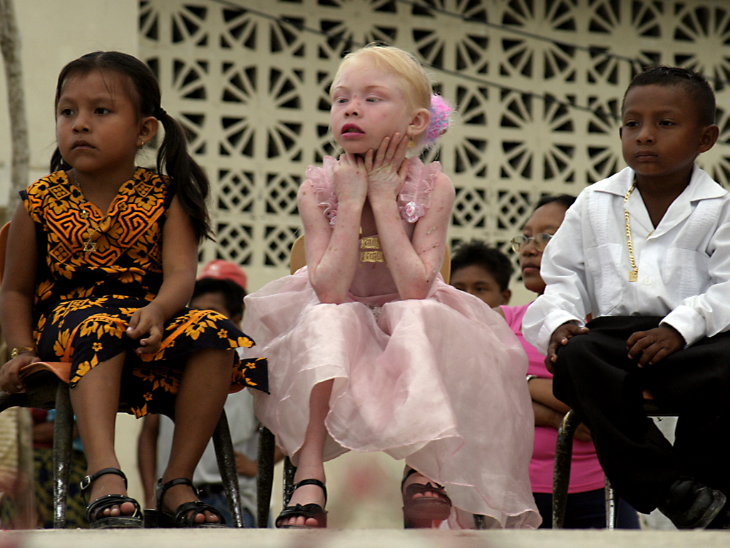 Deformutilation: Albinism Among The Kuna Indians
