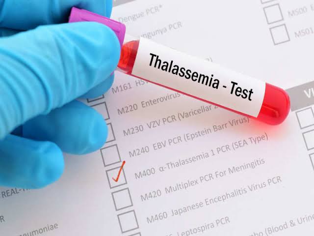 Thalassemia: Types, Causes, Symptoms and Treatment - Health4all