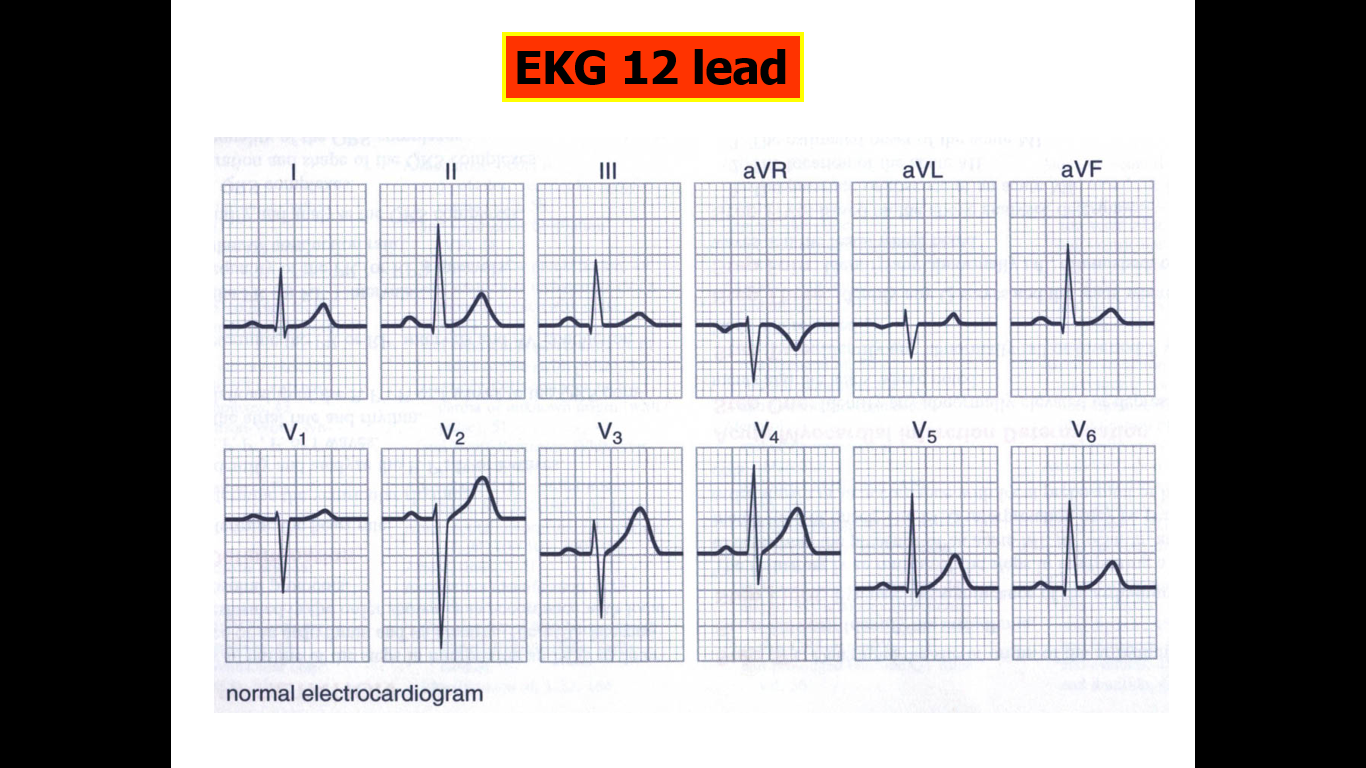 SAYANGI JANTUNG KITA: SADAPAN ECG, EKG