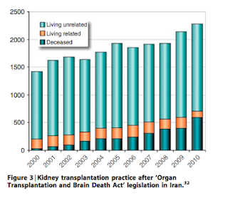 Best post I have read on how to pay donors for kidneys – Precious ...