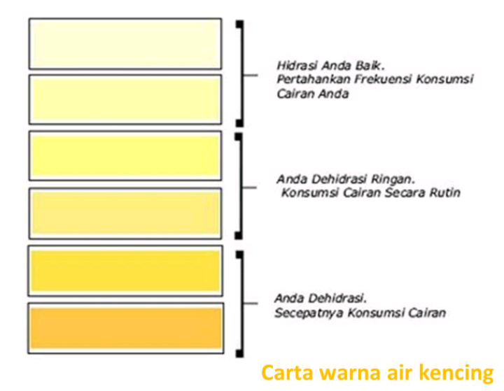 Ketahui Kondisi Kesehatan dari Beragam Warna Urine Berikut Ini