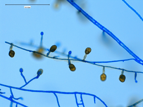 Fun With Microbiology (What's Buggin' You?): Stemphylium species